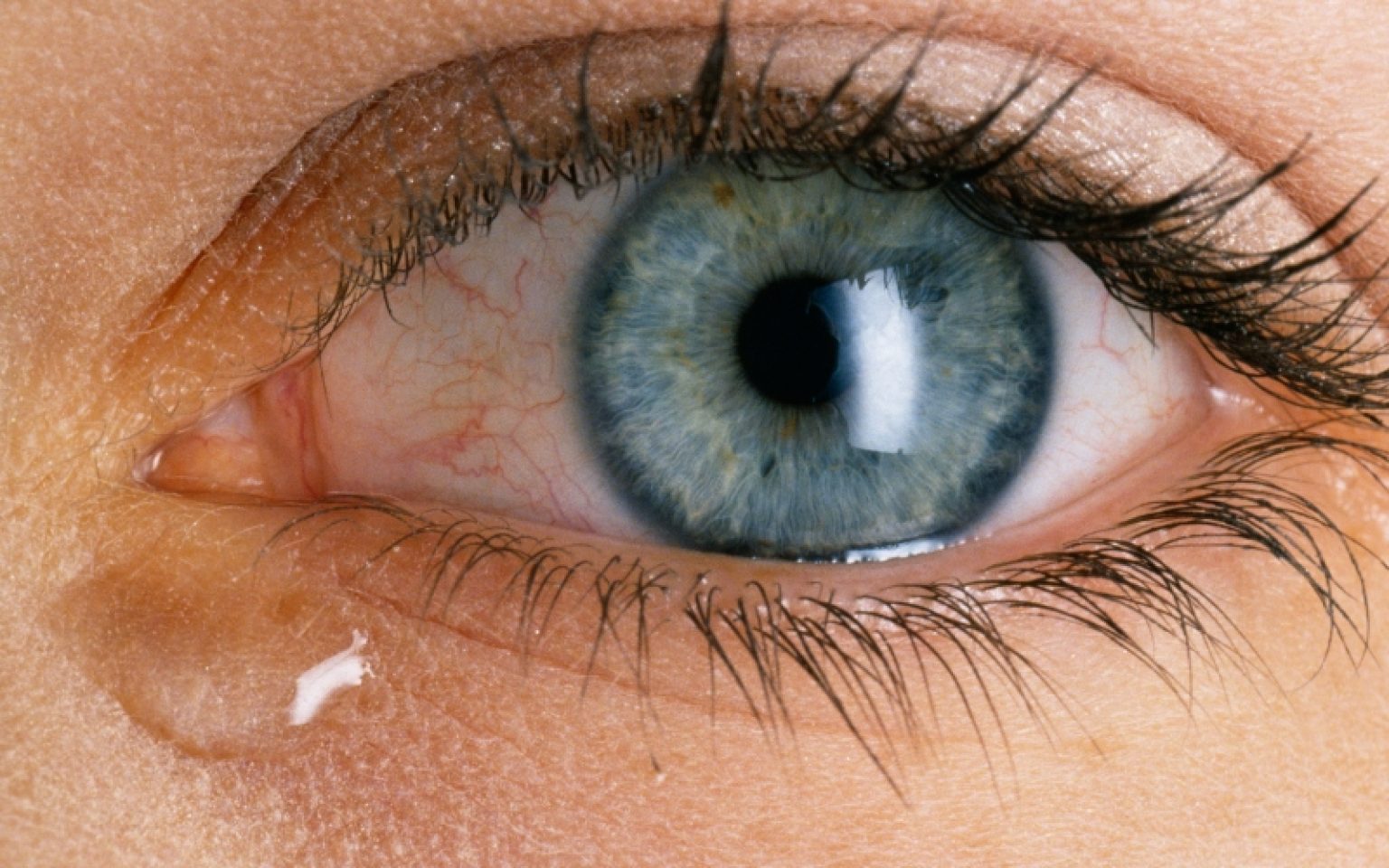 The Spiritual Meaning of Pain in The Left Eye: Avoid Overwhelm