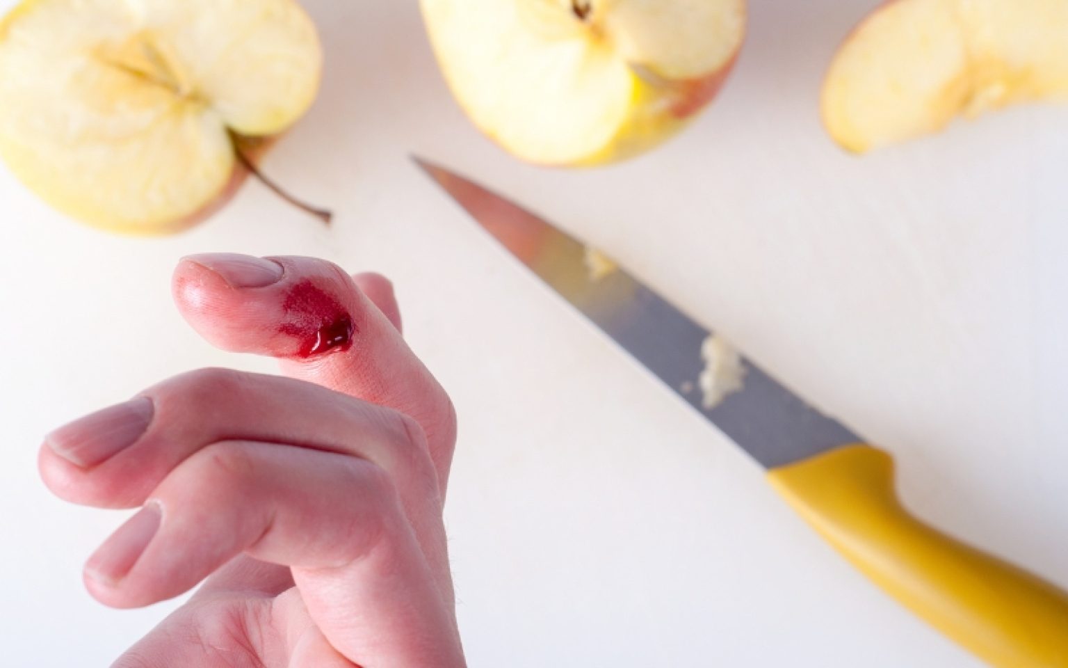 The Spiritual Meaning of Cutting a Finger - Change is Necessary