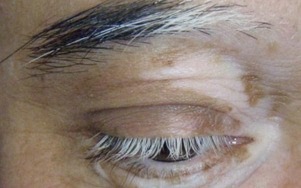 White Eyebrow Hair Spiritual Meaning and Symbolism - Spiritualify